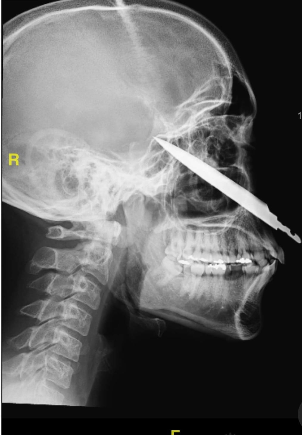 Northern Virginia Oral Surgery | Christopher E. Bonacci, DDS, MD, PC